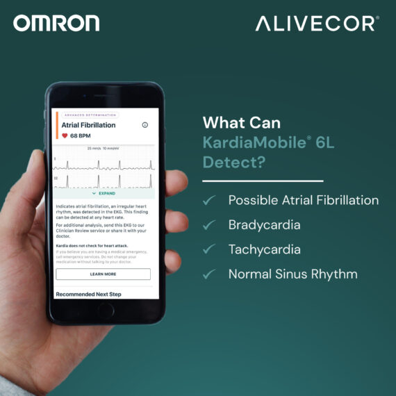 Alivecor – Kardia Mobile | Six-Lead Portable ECG Device - Respifix